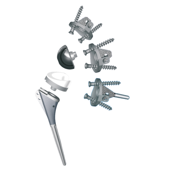 Upper Extremity Solutions - Fuse Medical