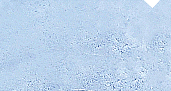 FuseChoice - Fuse Medical