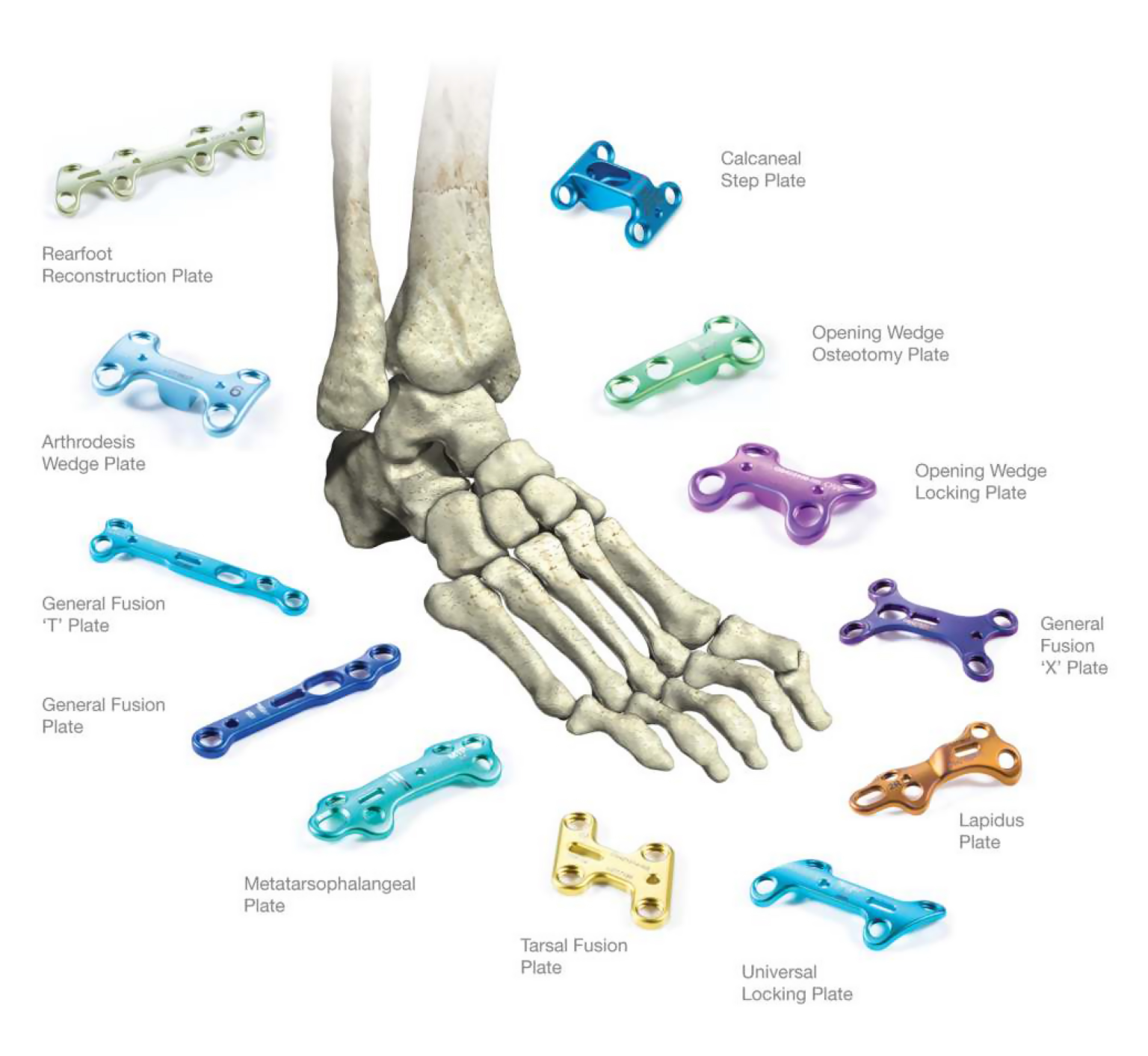 Foot Plating Systems - Fuse Medical